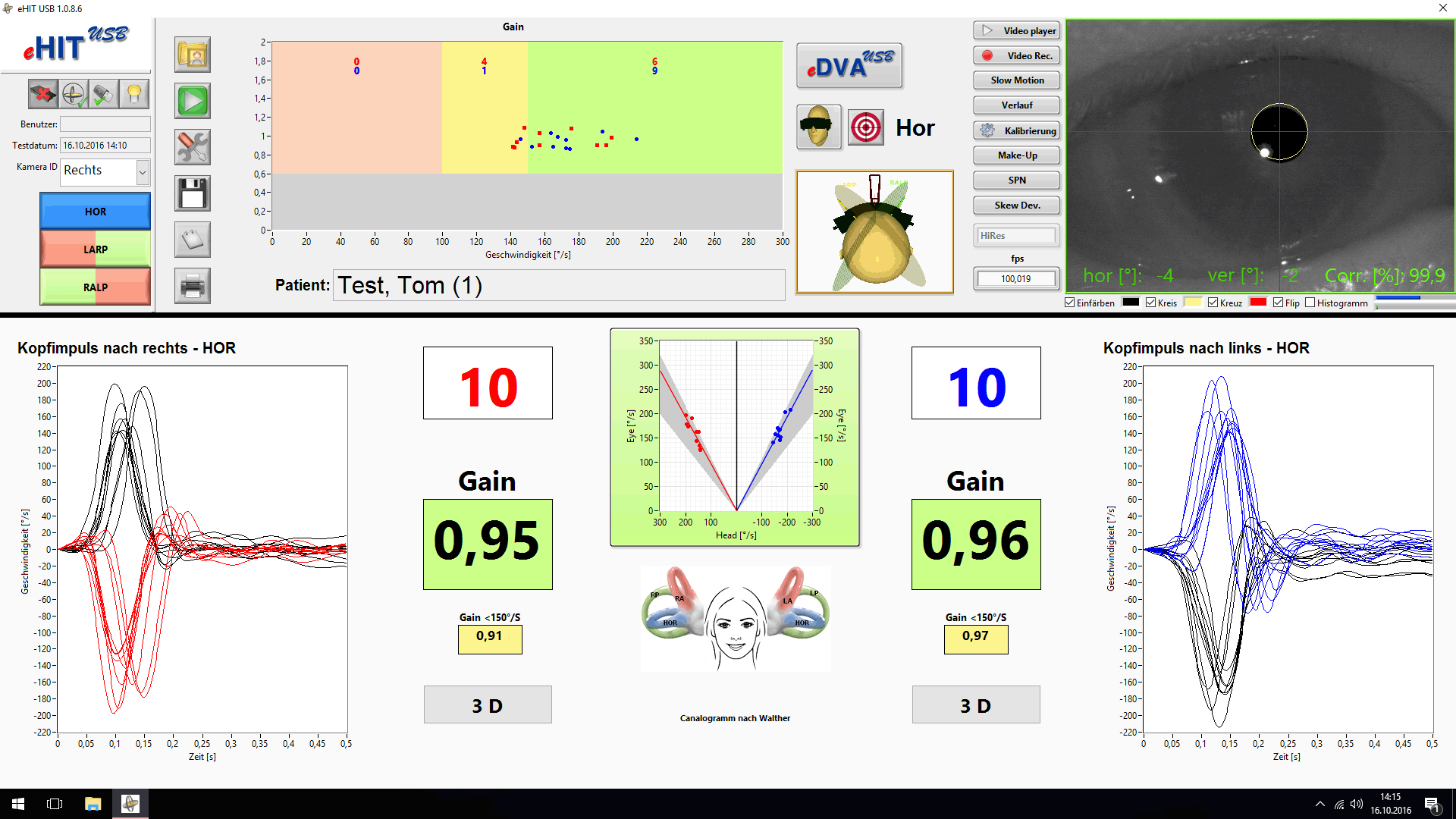 eHIT USB | EST! Medizintechnik AG