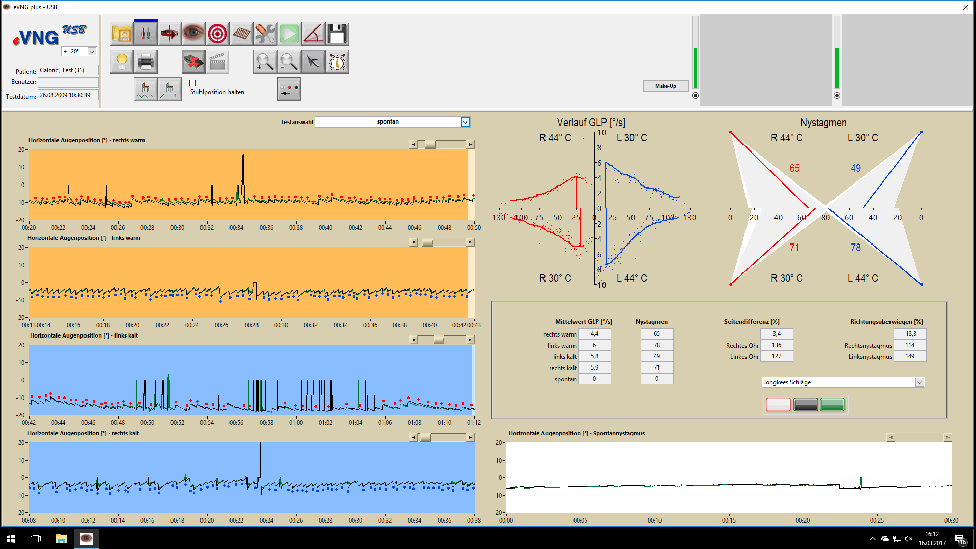 eHIT USB | EST! Medizintechnik AG